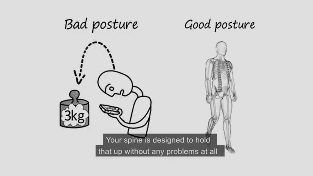 The importance of good posture - Dr. Massimo Colleoni